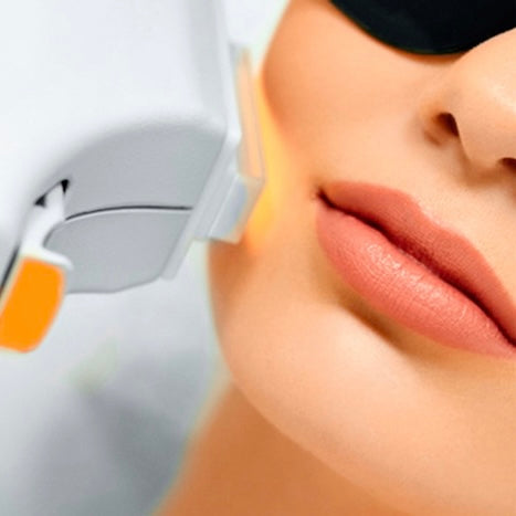 Fotorejuvenecimiento IPL – MIMACOS